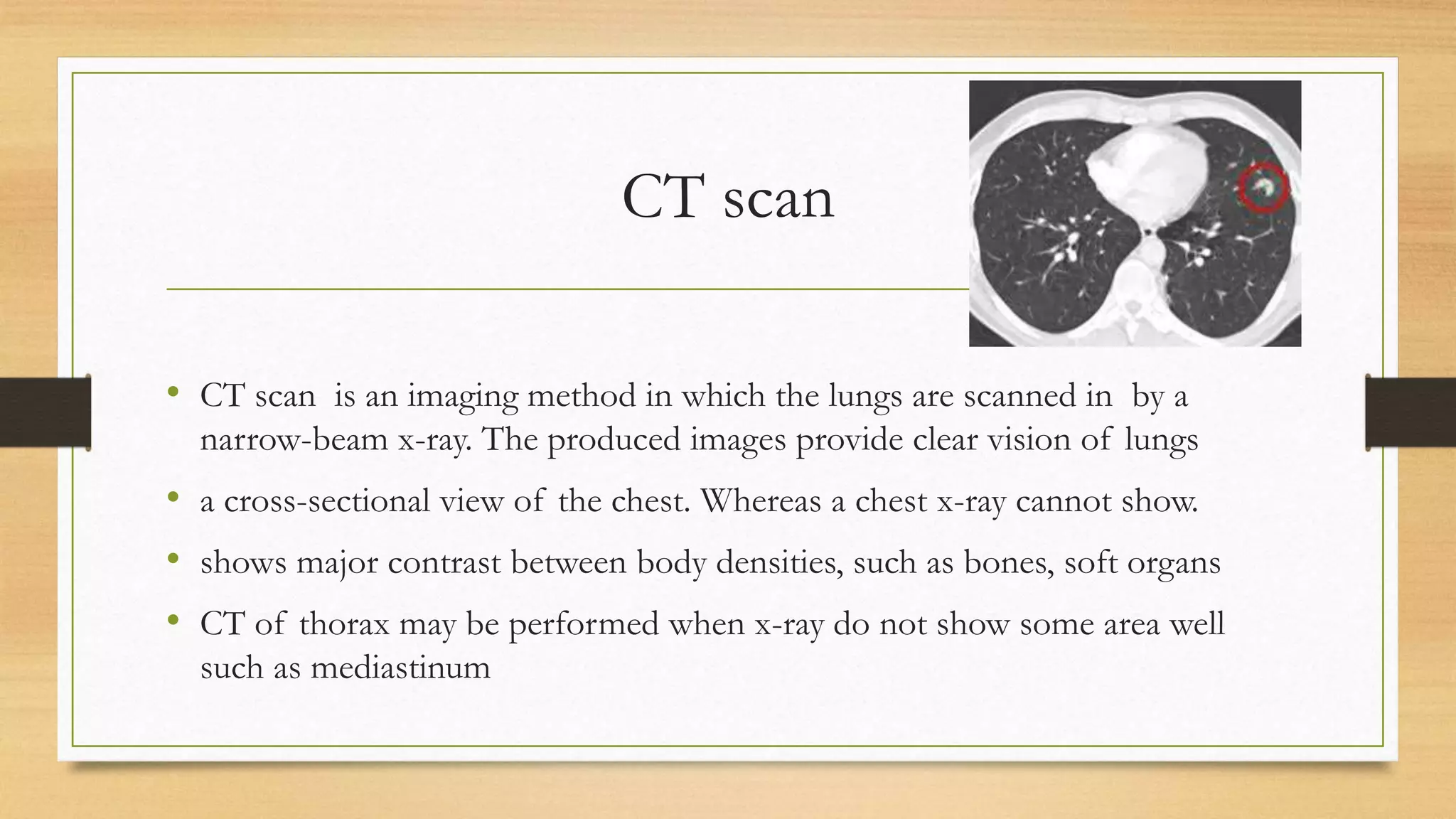 Ppt on diagnostic in respiratory mahi | PPTX