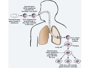 PPT on Gene therapy.ppt fbbb hfffvbn ghjn | PPT
