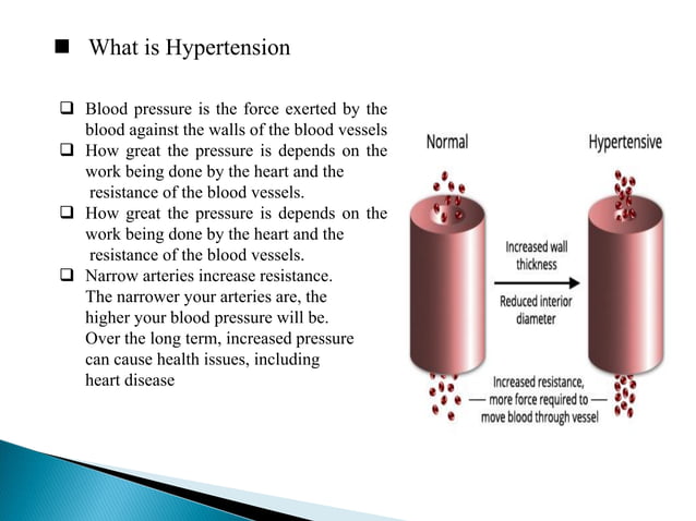 Ppt on hypertension | PDF