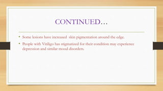 PPT ON LEUCODERMA.pptx