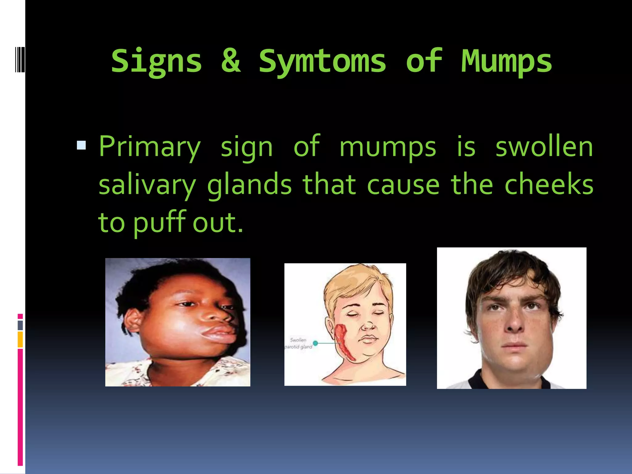 Ppt on mumps--a contagious disease | PPT