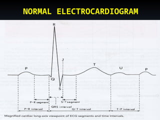 PPt on Normal ECG & P Wave with Normal ECG & P Wave.ppt