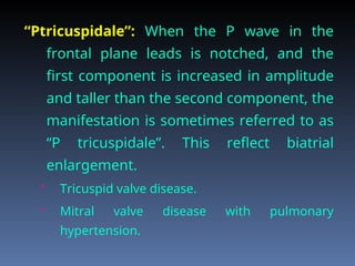 PPt on Normal ECG & P Wave with Normal ECG & P Wave.ppt