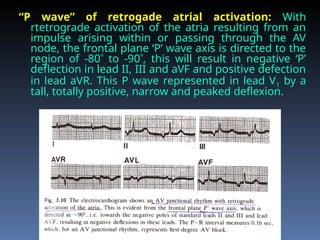 PPt on Normal ECG & P Wave with Normal ECG & P Wave.ppt