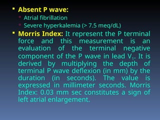 PPt on Normal ECG & P Wave with Normal ECG & P Wave.ppt