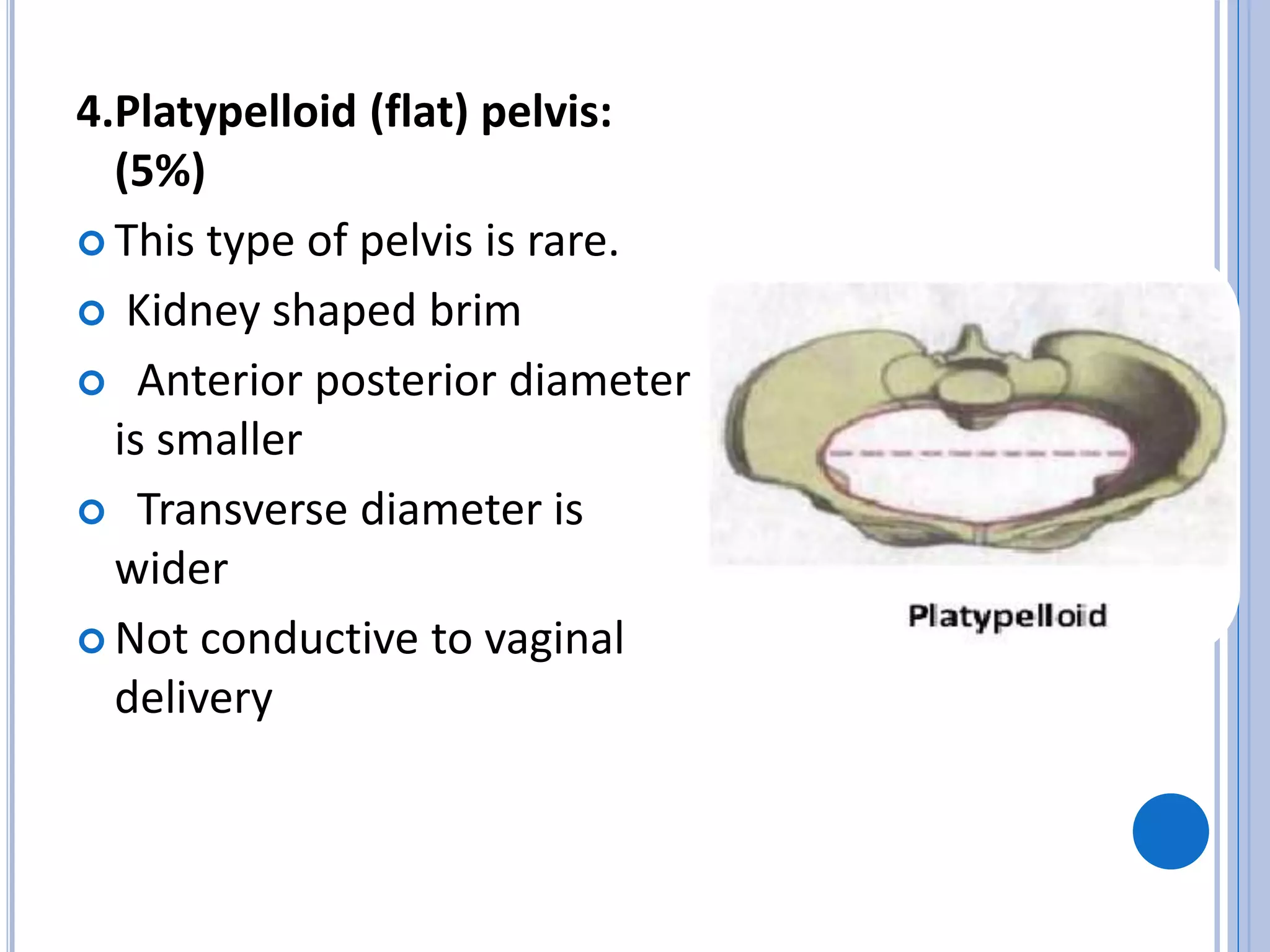 Ppt on pelvis | PPTX
