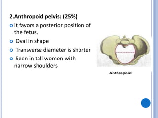 Ppt on pelvis | PPTX