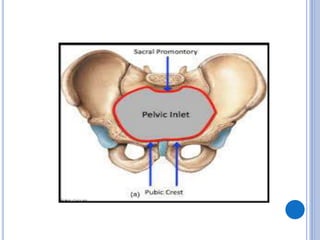Pelvic Inlet Vs Pelvic Outlet