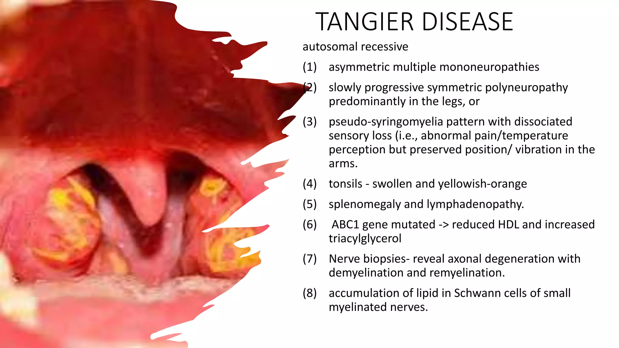 ppt on peripheral neuropathy.pptx