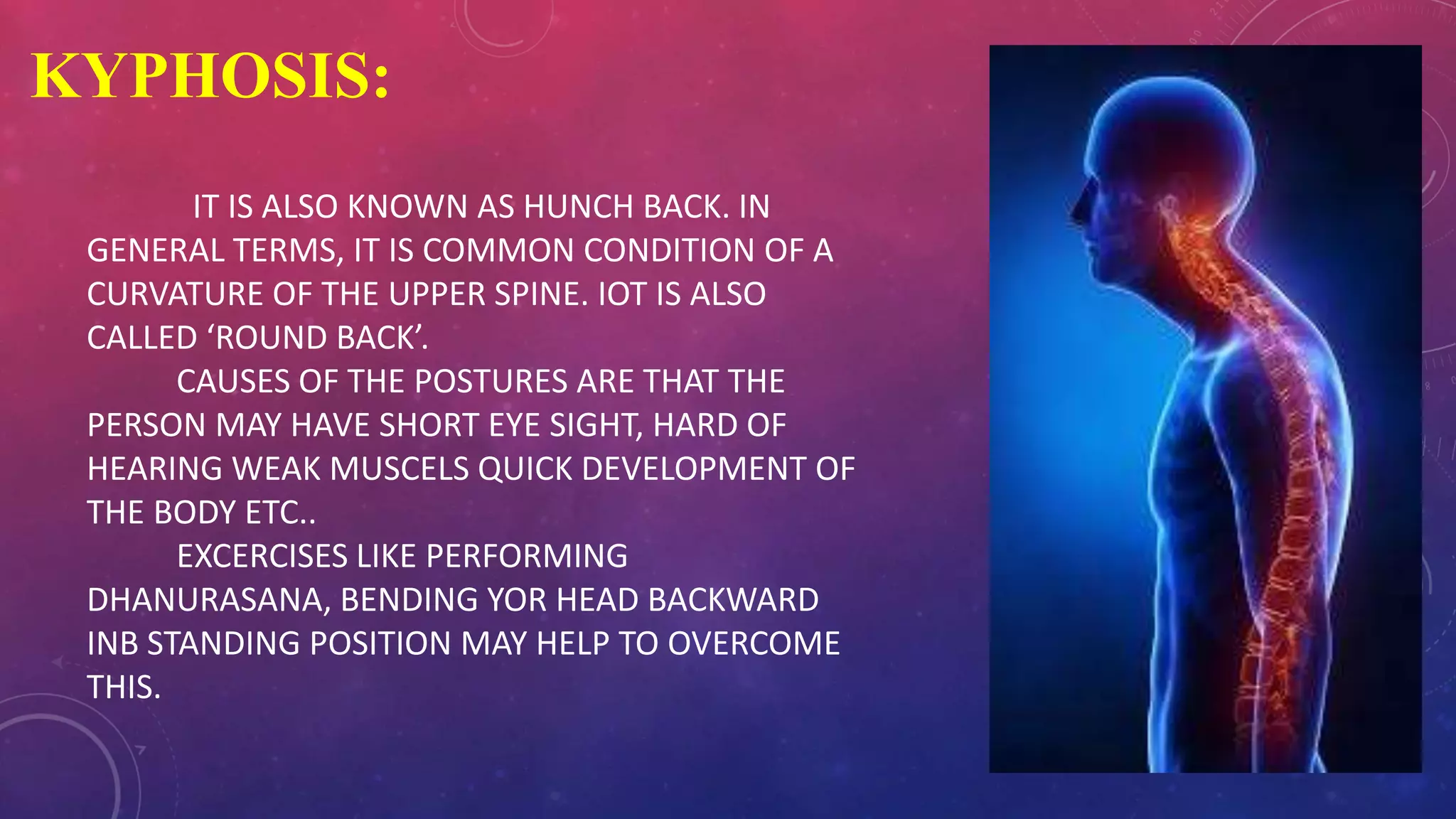 Ppt on postures | PPTX