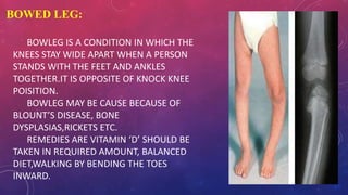 Ppt on postures | PPTX