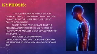 Ppt on postures | PPTX