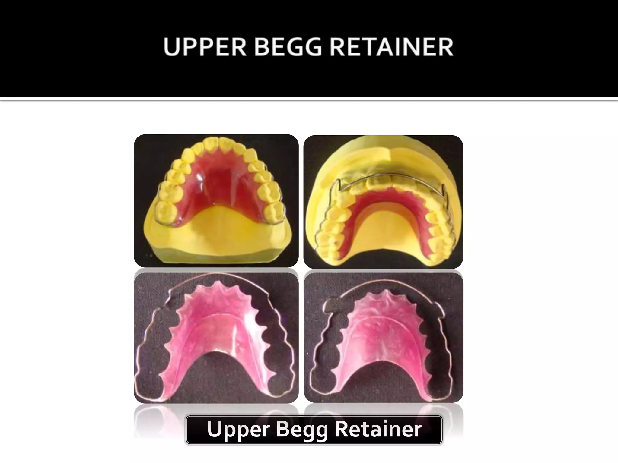 Removable appliance | PPTX