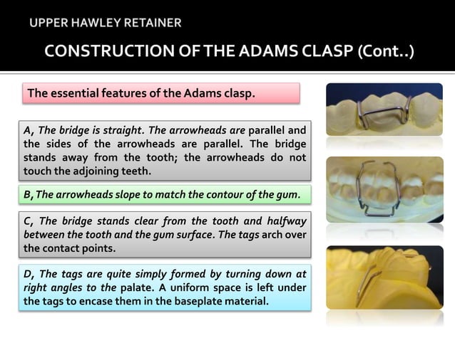 Removable appliance | PPTX | Dental Health | Diseases and Conditions