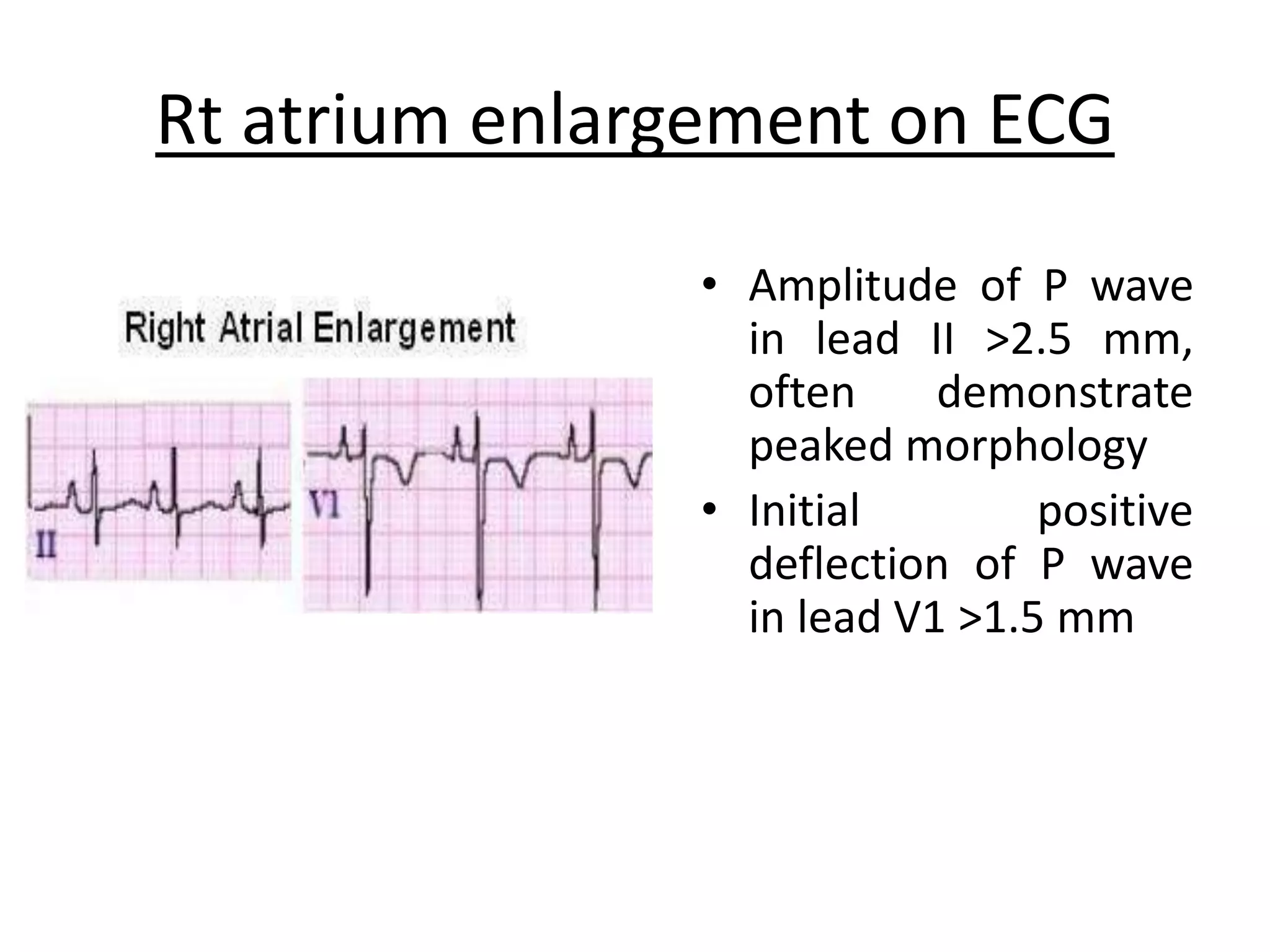 Right ATRIUM.pptx