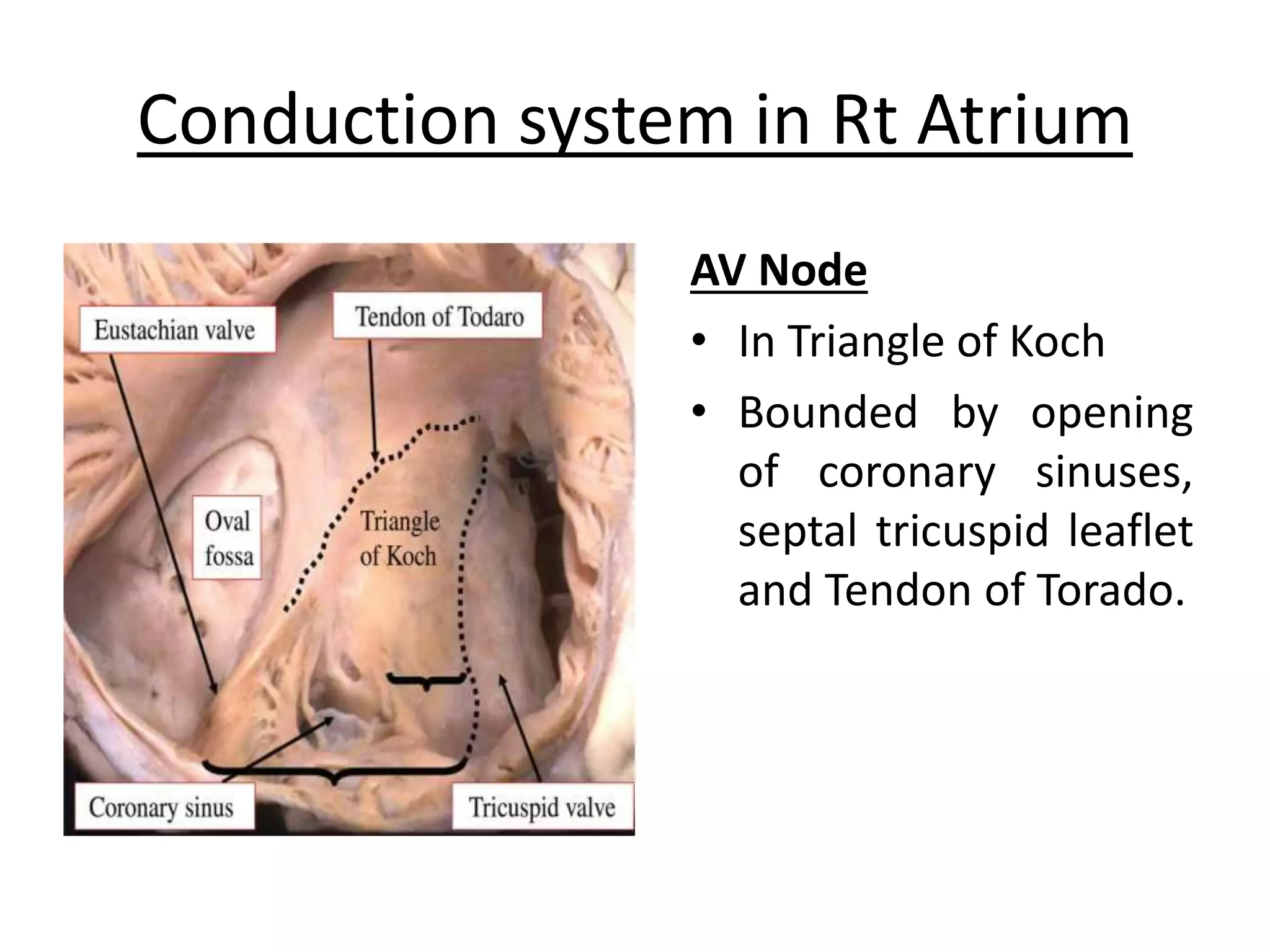 Right ATRIUM.pptx