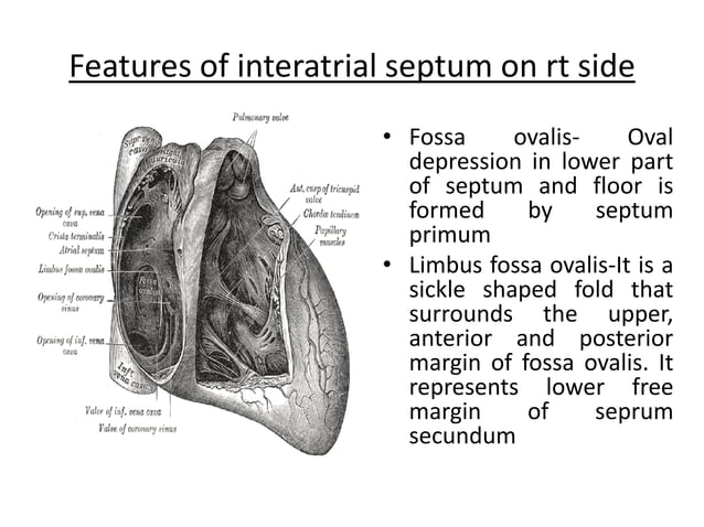 Right ATRIUM.pptx | Heart and Cardiovascular Diseases | Diseases and ...