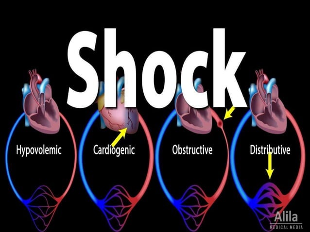 PPT On Shock.pptx