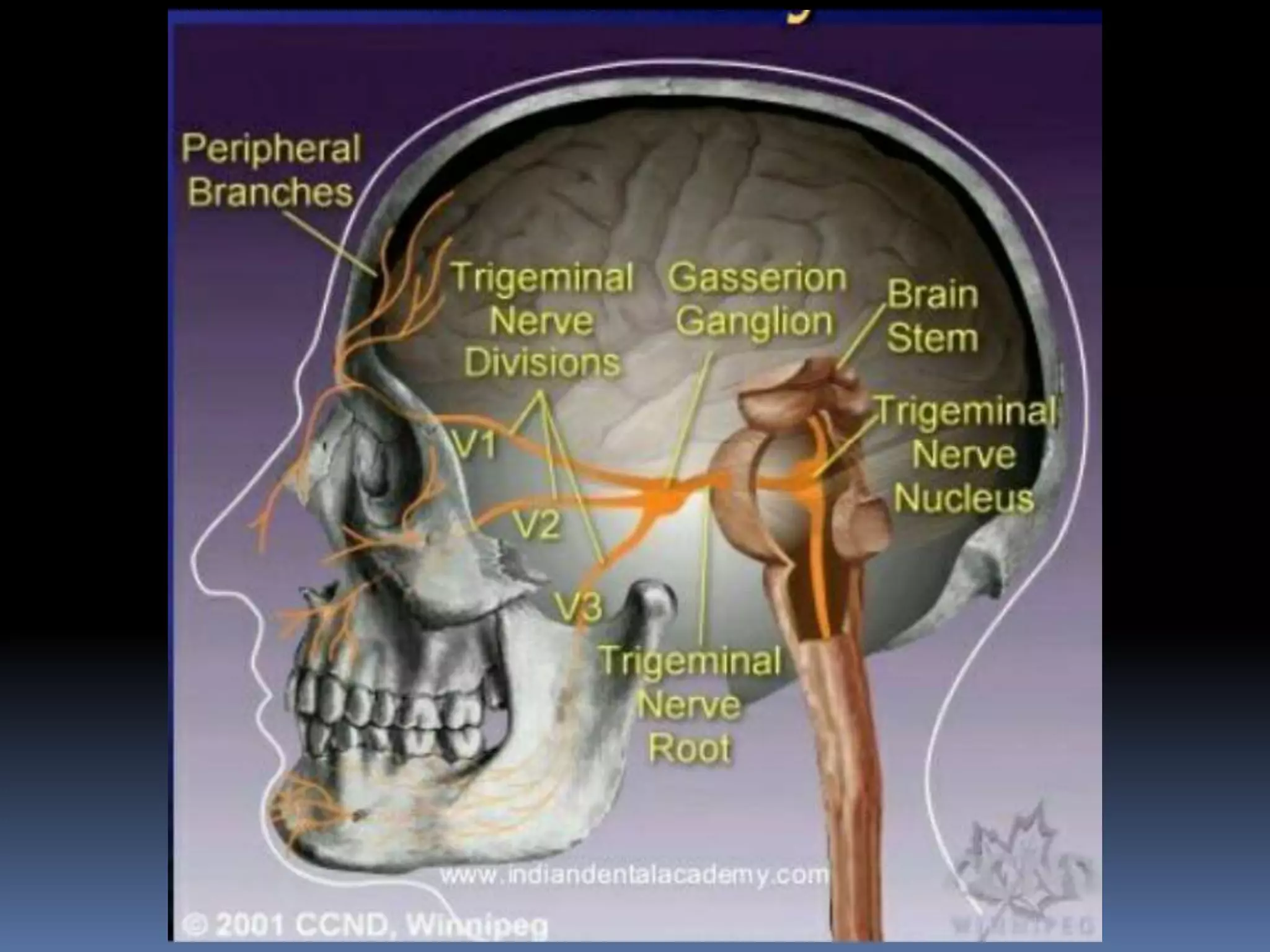 Presentation on Trigeminal Neuralgia | PPTX