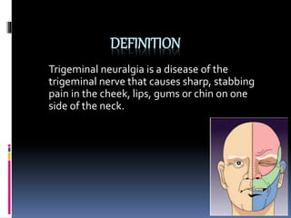 Presentation on Trigeminal Neuralgia | PPTX