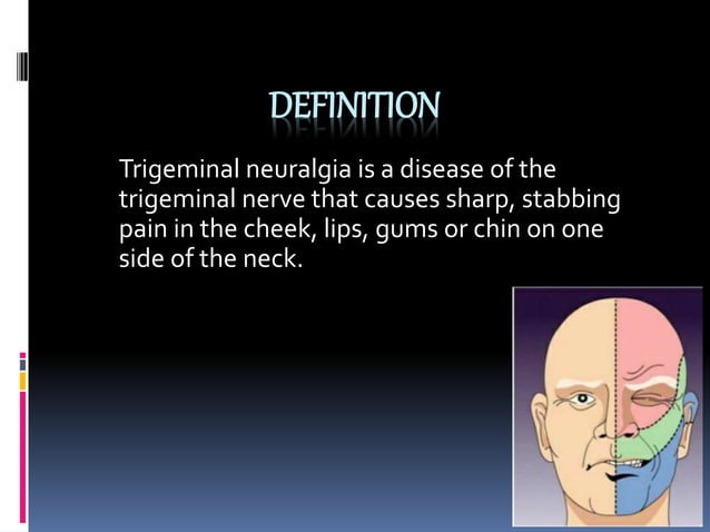 Presentation on Trigeminal Neuralgia | PPTX