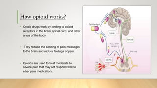 Ppt opioid saved | PPTX