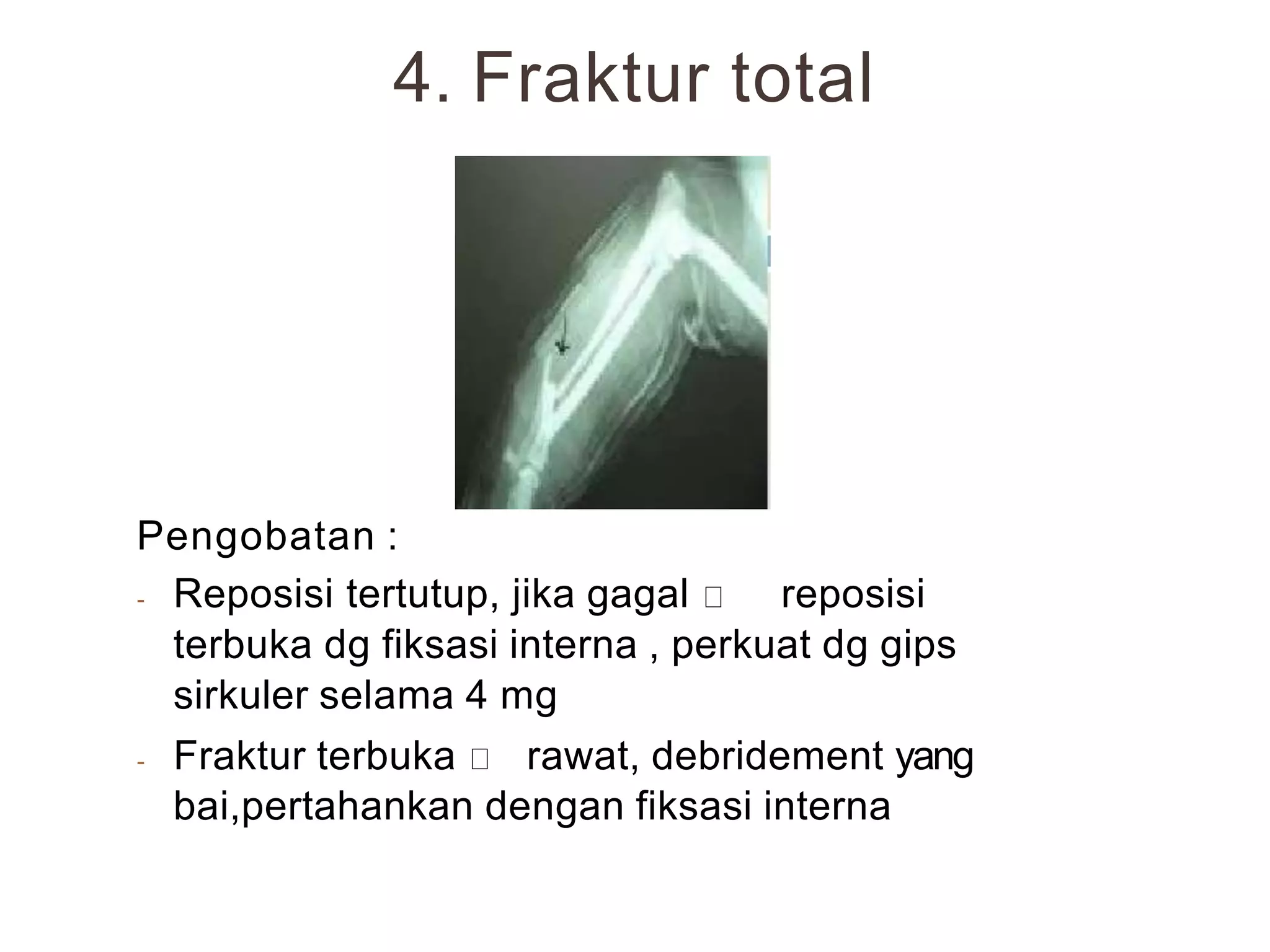 PPT Ortho.pptx