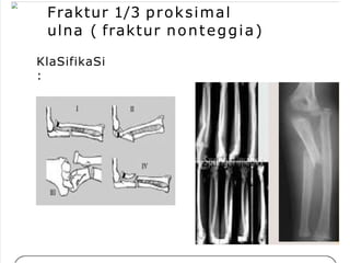 PPT Ortho.pptx
