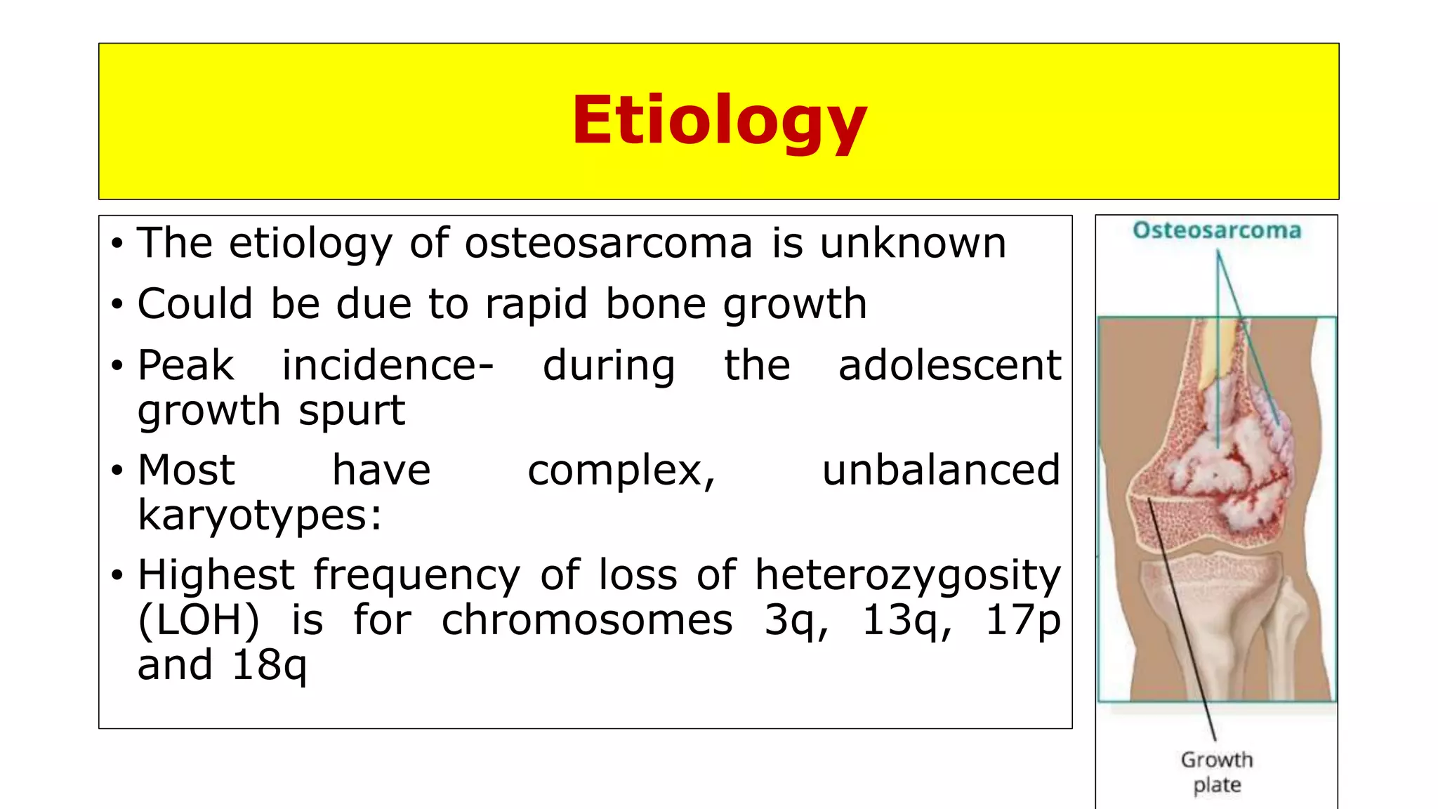 PPT osteosarcoma.pptx