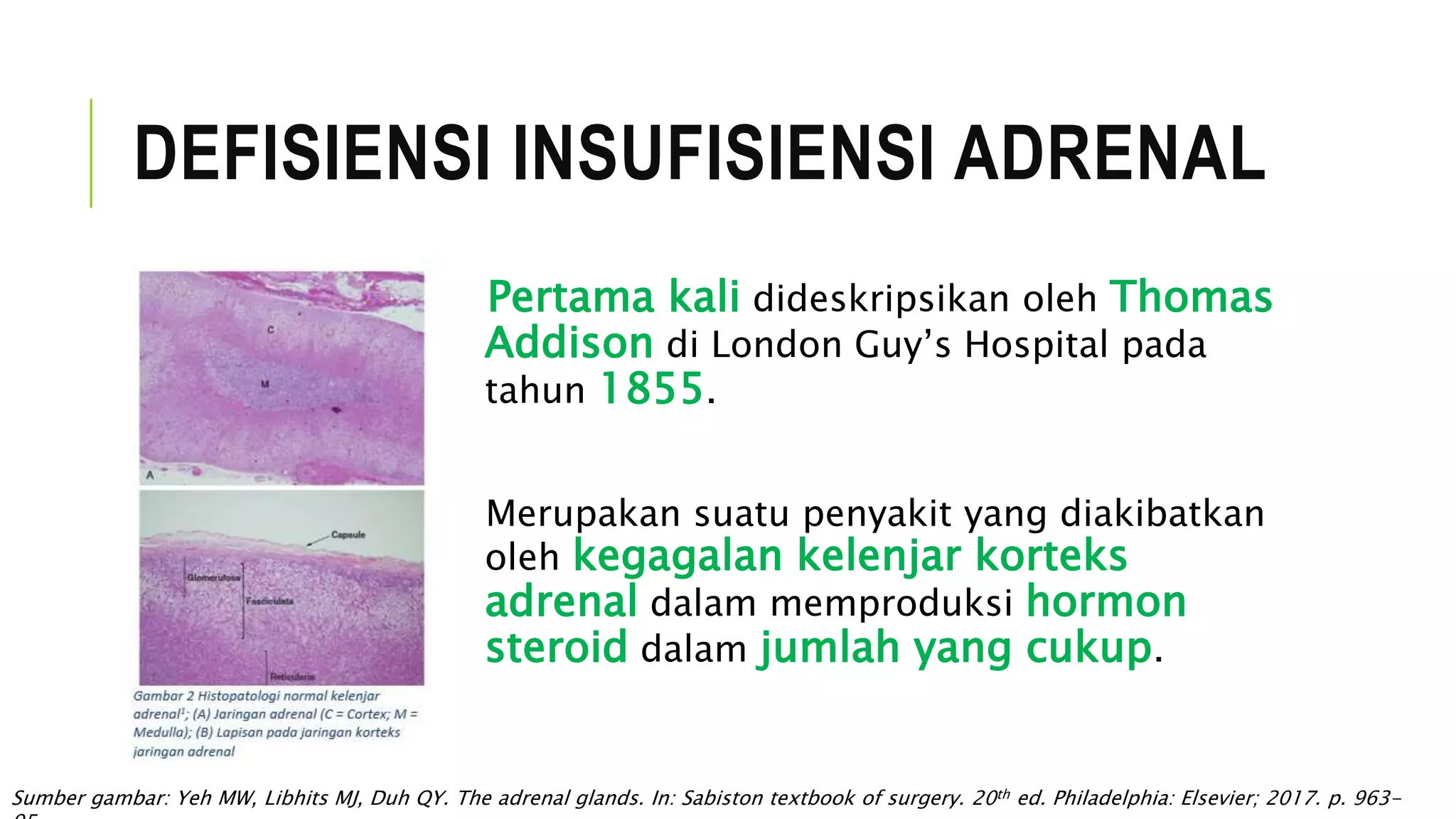 Insufisiensi Kelenjar Adrenal | PPTX