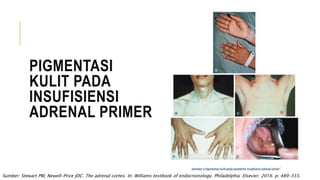 Insufisiensi Kelenjar Adrenal | PPTX