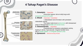 PPT Paget's Disease Anthony for learning Musculoskeletal | PPTX