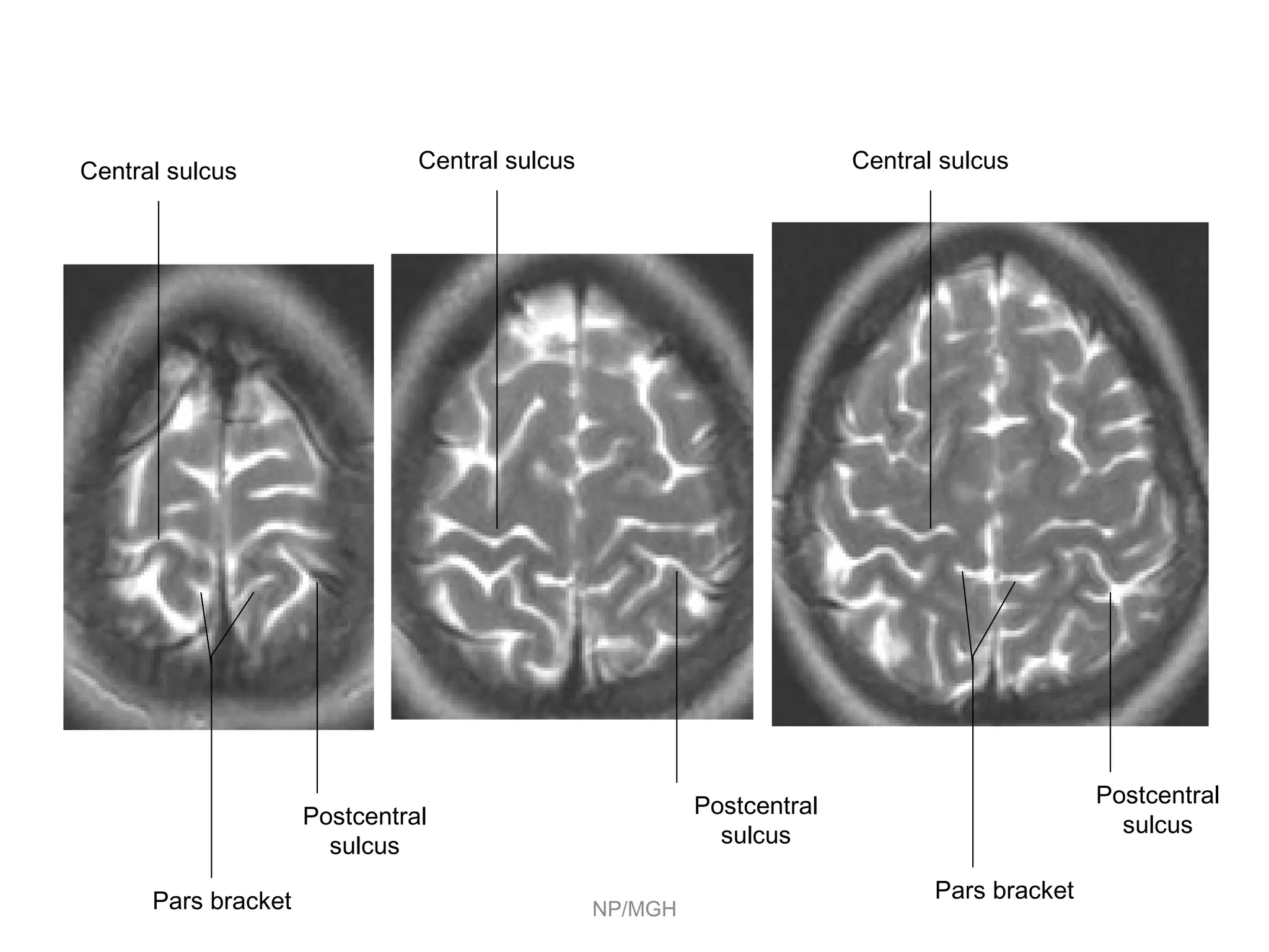 Ppt parietal lobe | PPT