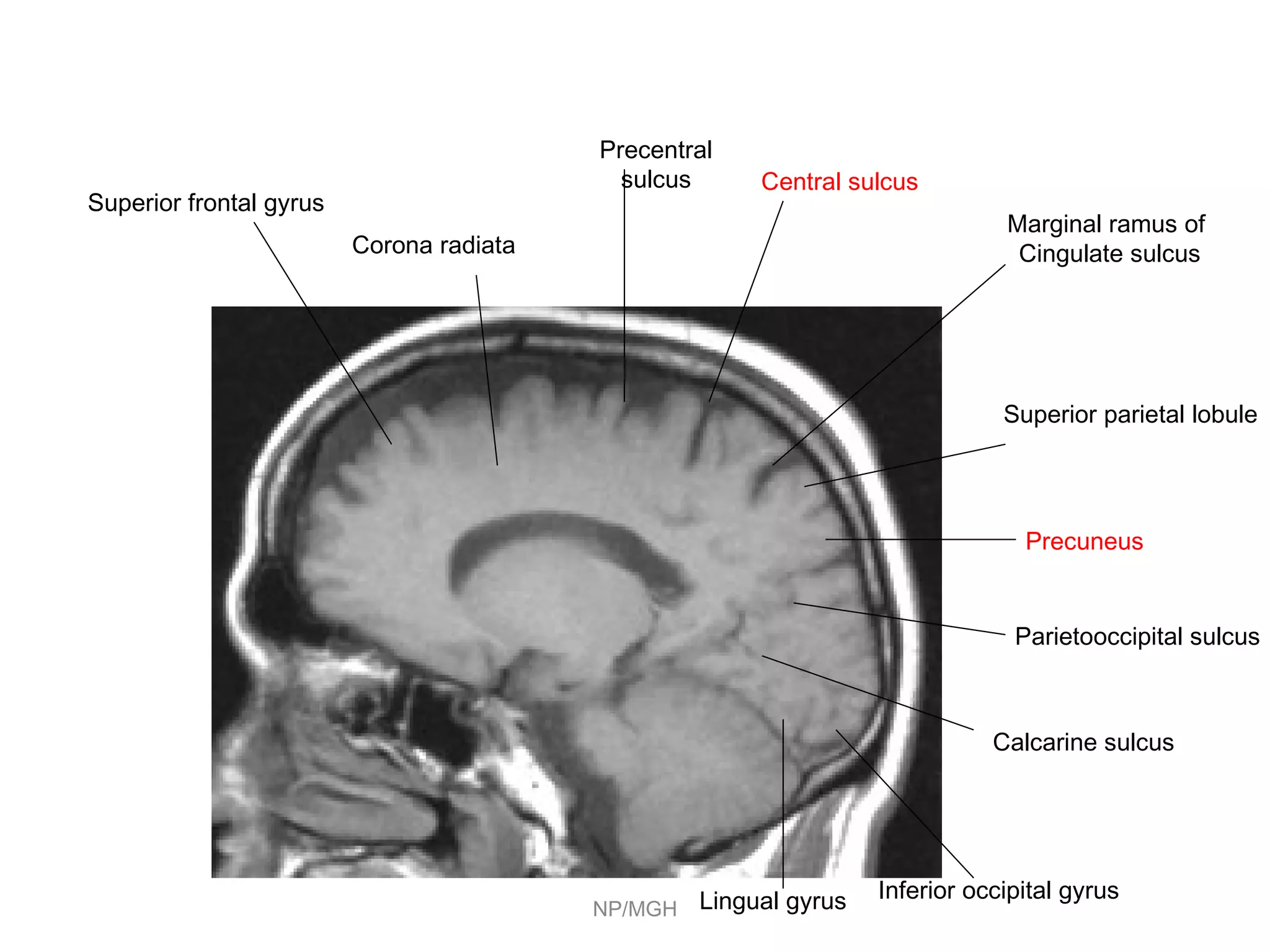 Ppt parietal lobe | PPT