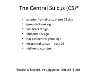 Ppt parietal lobe | PPT