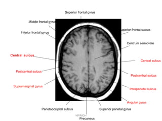 Ppt parietal lobe | PPT