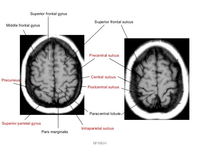 Ppt parietal lobe