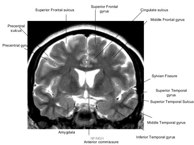 Ppt parietal lobe