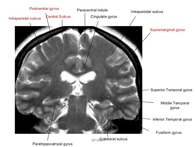 Ppt parietal lobe