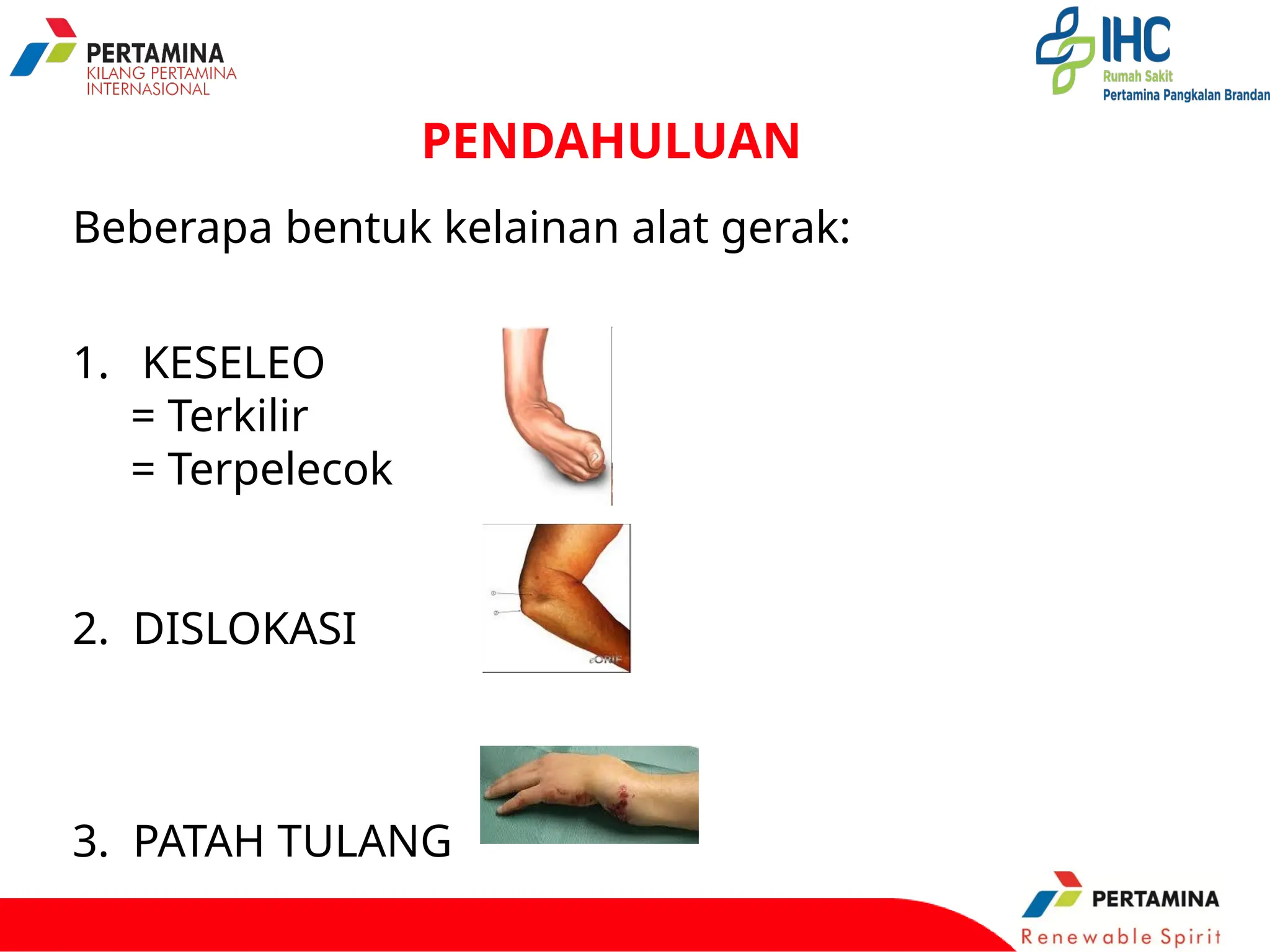 ppt patah tulang 22.pptx FRIST AIDER KPI | PPTX