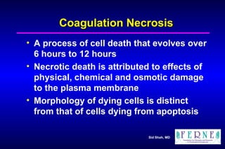 pathophysiology | PPS