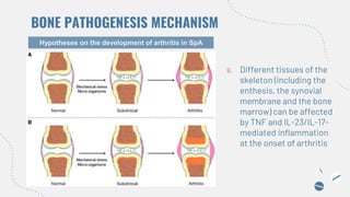 ABNORMALITAS TULANG PADA SPONDYLOARTHRITIS.pptx | Bone and Joint ...