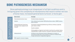ABNORMALITAS TULANG PADA SPONDYLOARTHRITIS.pptx | Bone and Joint ...