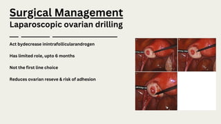 Comprehensive Overview of Polycystic Ovary Syndrome (PCOS ...