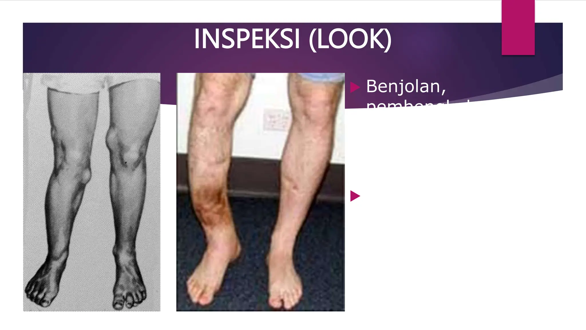 PPT PENGKAJIAN SISTEM MUSKULOSKELETAL 2.pptx