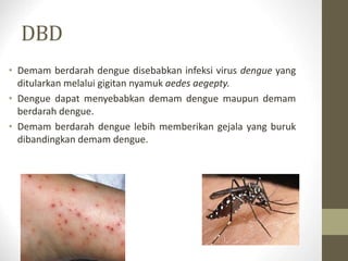 PPT PENYAKIT PANCAROBA DAN PENCEGAHANNYA.ppt