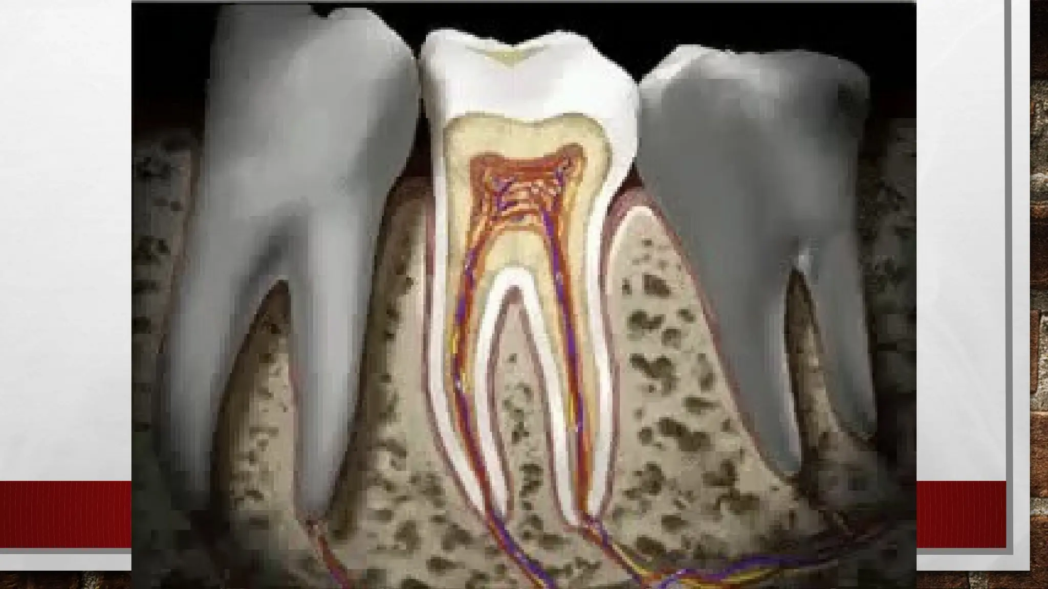 ppt_penyuluhan_Gigi_berlubang_karies.pptx