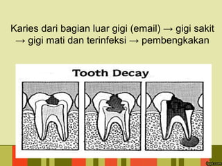 Ppt penyuluhan karang gigi karies | PPT