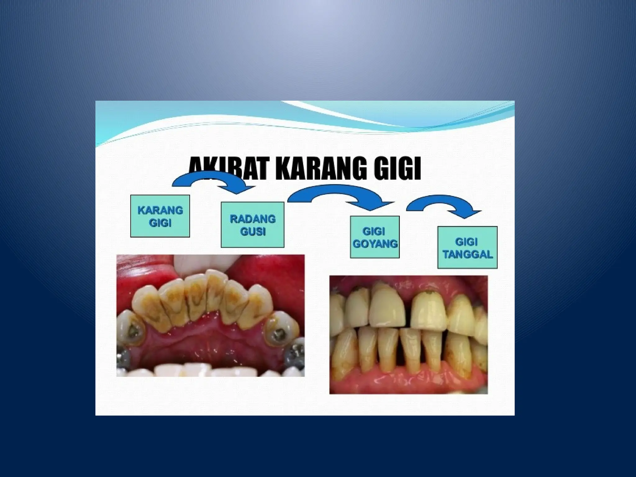 PPT PENYULUHAN KESEHATAN GIGI DAN MULUT.pptx