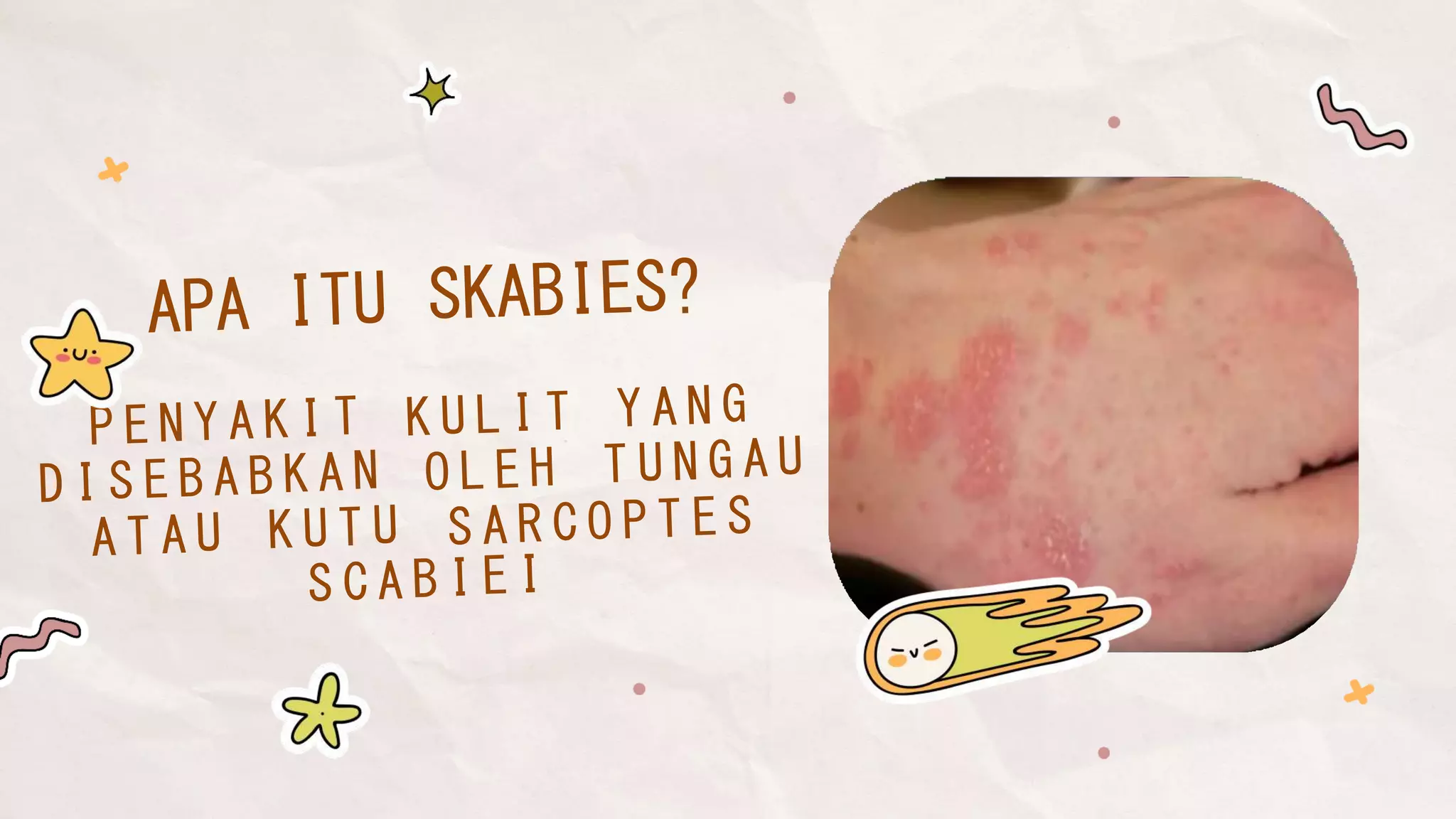 PPT Penyuluhan Skabies 5 September - 1 Oktober 2022.pptx